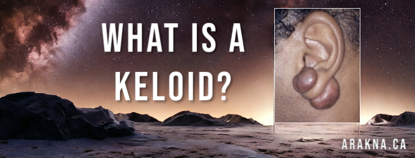 Keloids – ARAKNA Body Jewelry